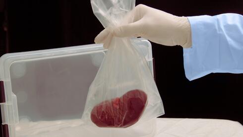 How Do They Harvest The Organs