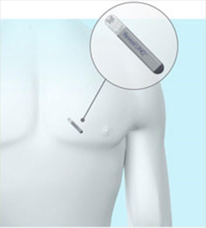 Внезапный обморок: почему это случается в Израиле и как теперь лечат