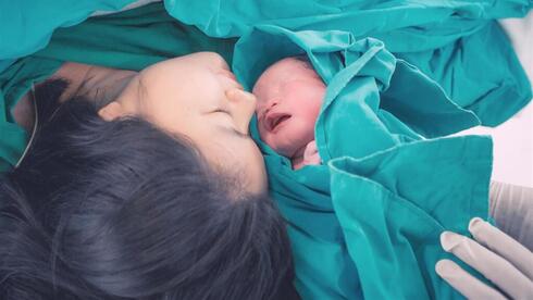 Doctors praise Israeli ban on extraperitoneal French C-section technique