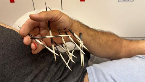 Porcupine attacks man in northern Israel: '41 quills, I thought I was ...