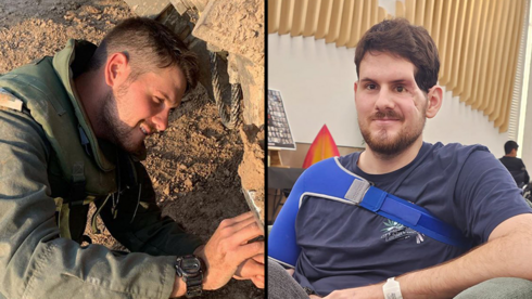 Severely wounded soldier undergoes 3D skull reconstruction